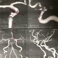 Brain space traveler／verycider｜音楽ダウンロード・音楽配信サイト mora ～“WALKMAN”公式ミュージックストア～